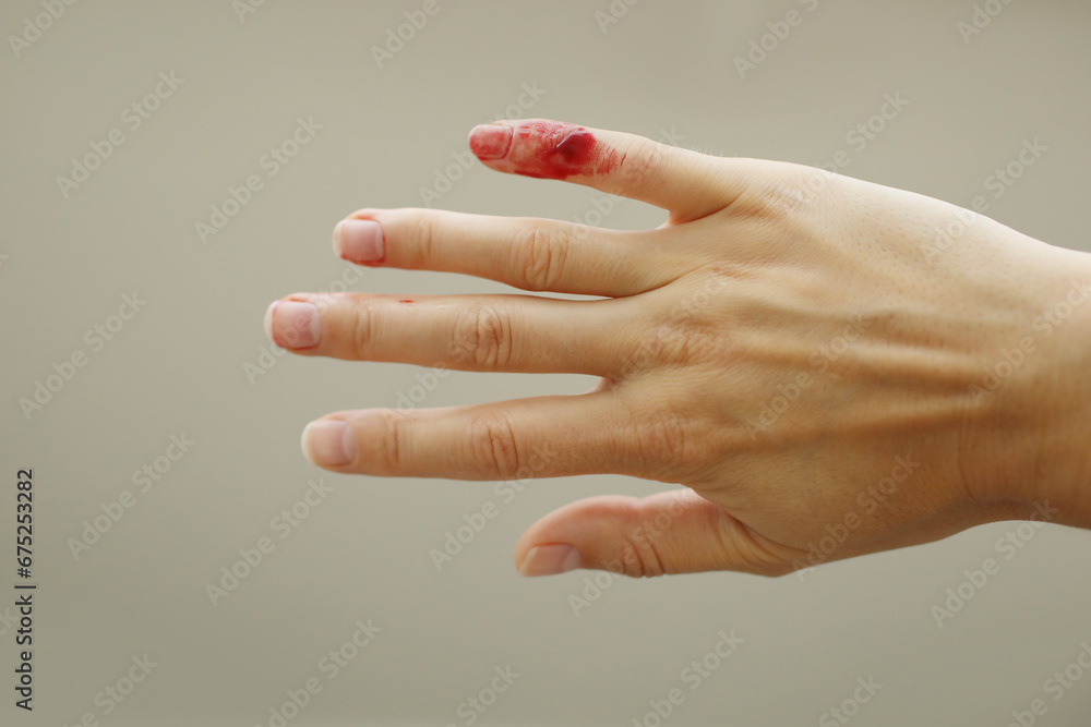 Female hand with red blood, little finger is bleeding profusely. Woman ...