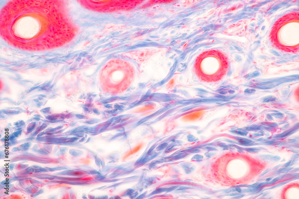 Characteristics Tissue of Human scalp, Skin human from general body ...