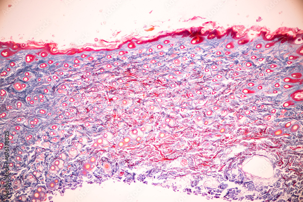 Characteristics Tissue of Human scalp, Skin human from general body ...