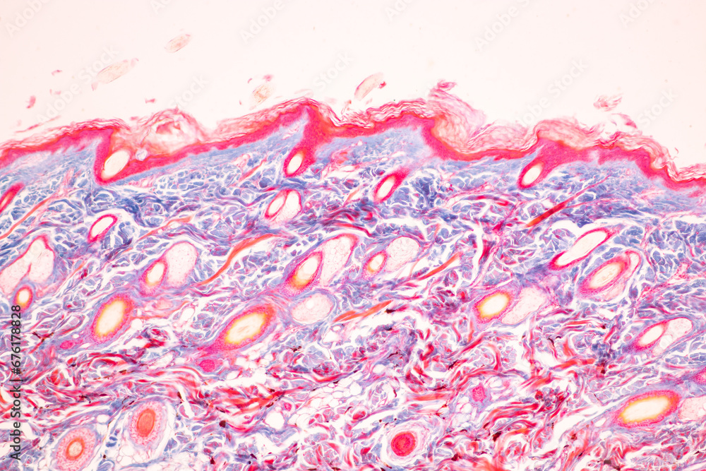 Characteristics Tissue of Human scalp, Skin human from general body ...