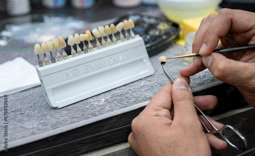 male checking A-D shade guide for tooth crowns to select the proper ...