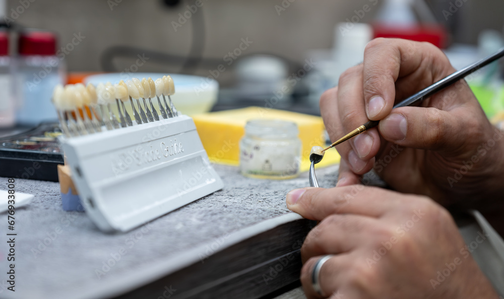 male checking A-D shade guide for tooth crowns to select the proper ...