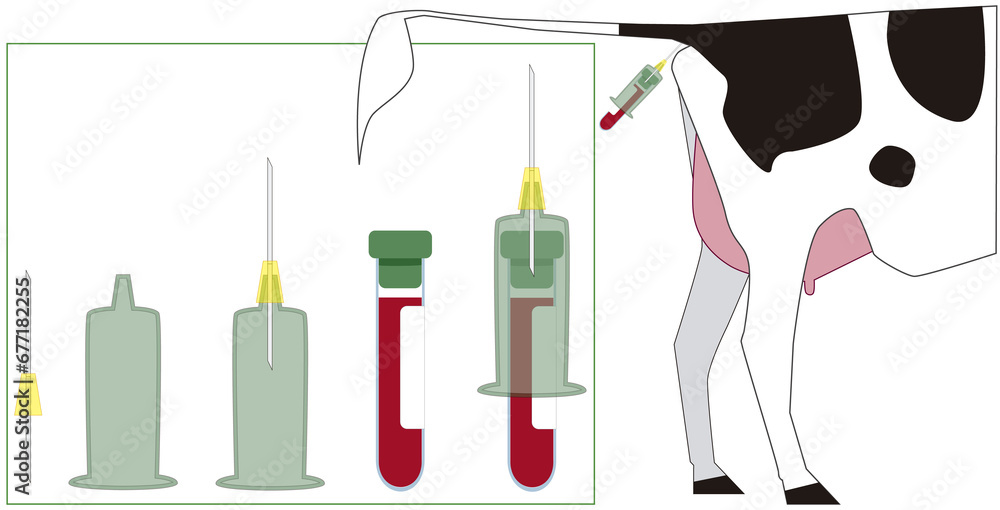 Needle and hood for blood collection tube with cap color green ...