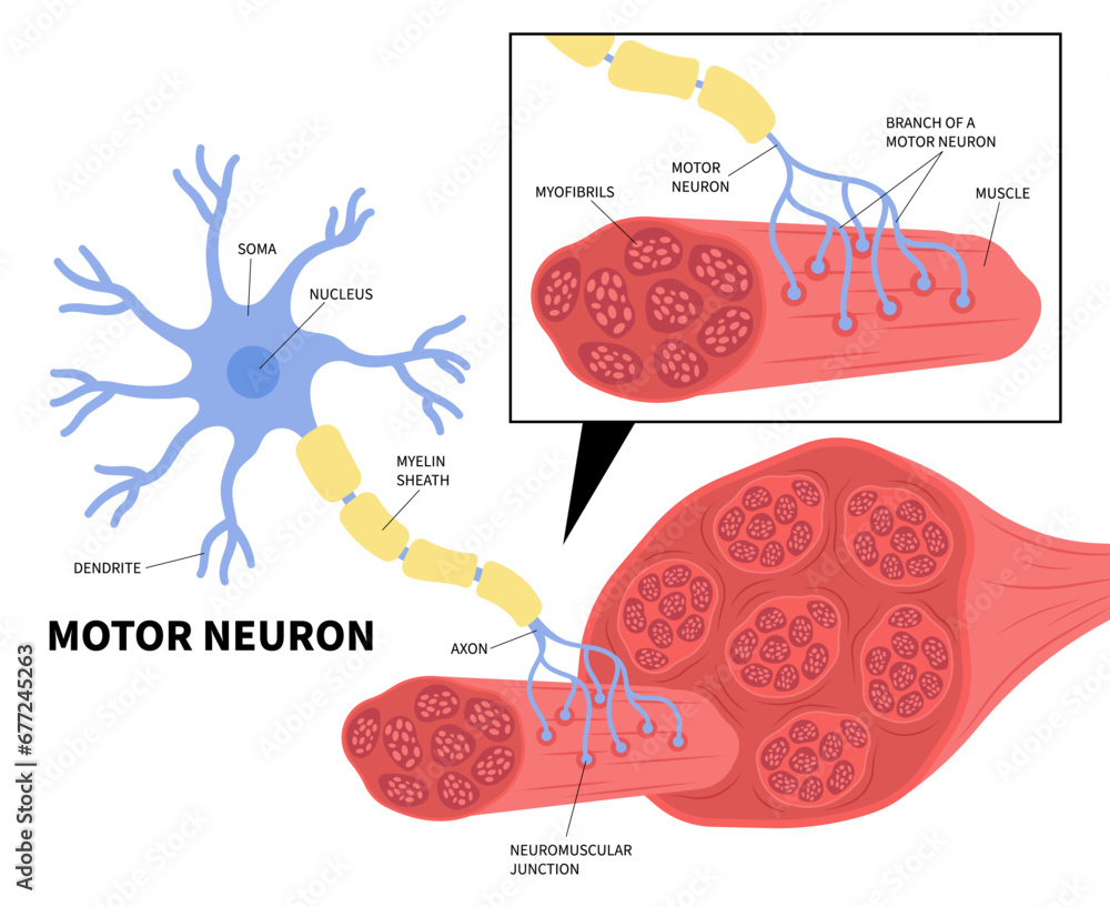 The neurological neuropathy anatomy of Motor neuron cell cause ...