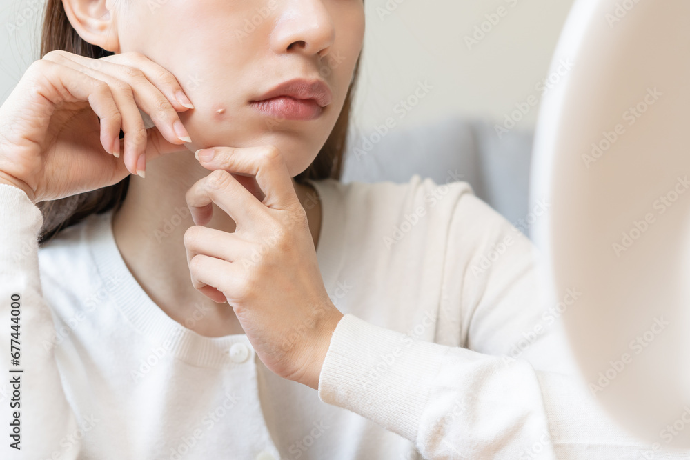Expression worry asian young woman hand touching pustule around the ...