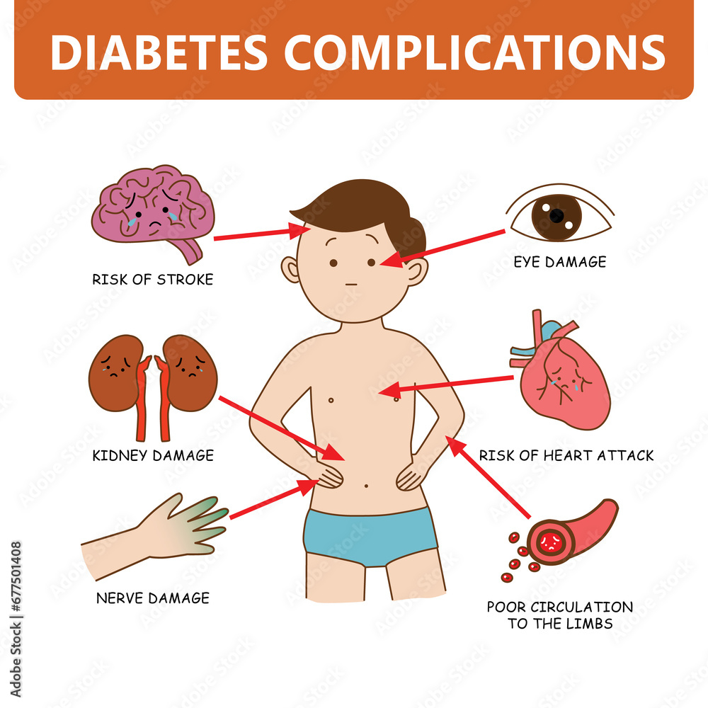 Diabetes complications with man symptom infographic cartoon ...
