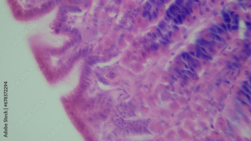 Thin section of human stomach with contrast under a microscope ...