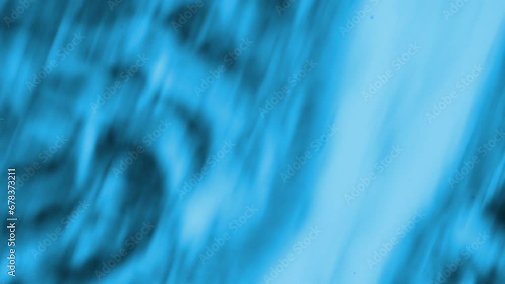 Thin section of human stomach with contrast under a microscope ...