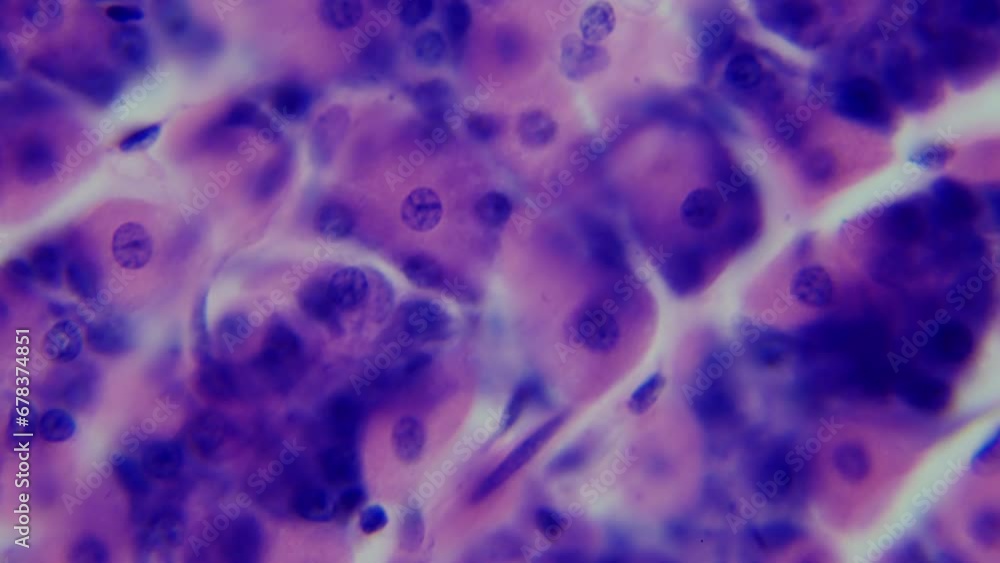 Thin section of human stomach with contrast under a microscope ...