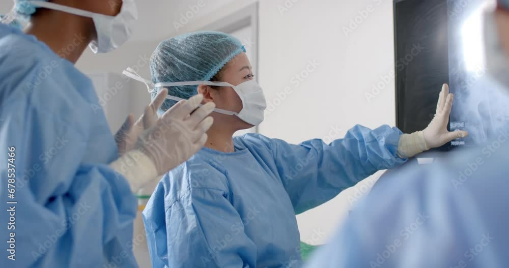 Diverse female surgeons looking at x-ray scans in operating theatre ...