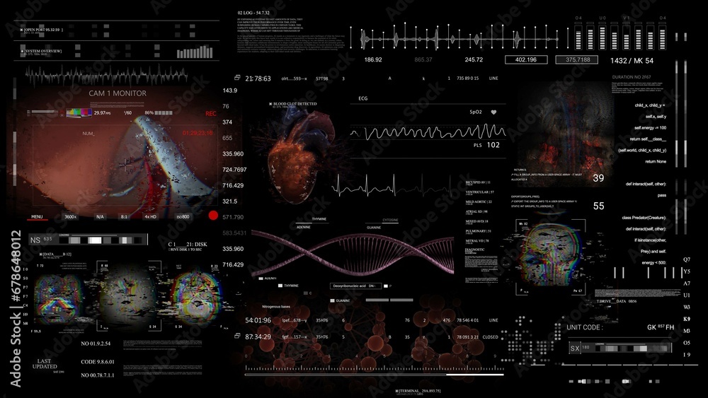 MRI x ray Scan, 3D Model.Medical monitor.HUD.Heads up display.Heart ...