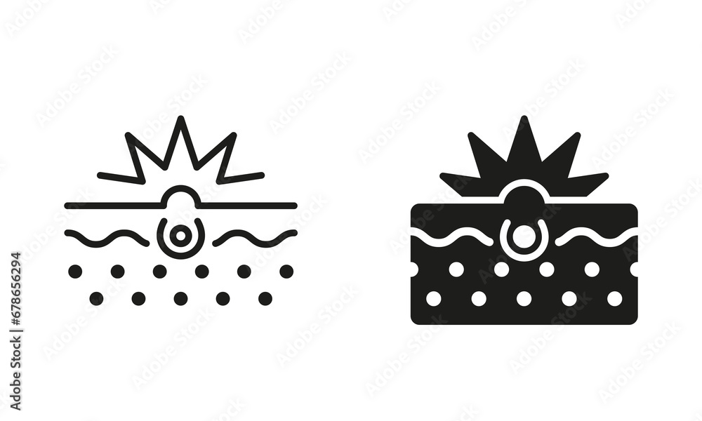 Allergy Reaction, Acne Medical Problem of Skin. Skin Pain Line and ...