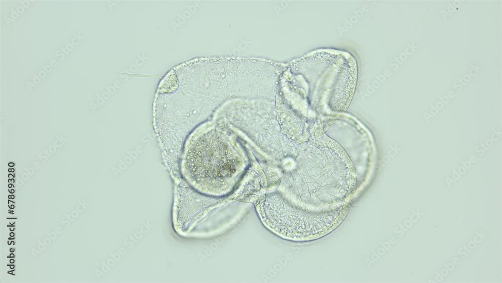 Pilidium larva of worm Heteronemertea under microscope, genus ...