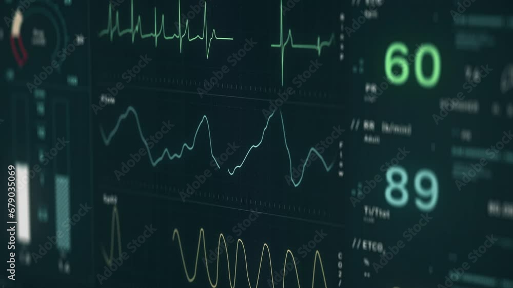 Respiratory rate monitoring system used at the modern healthcare ...