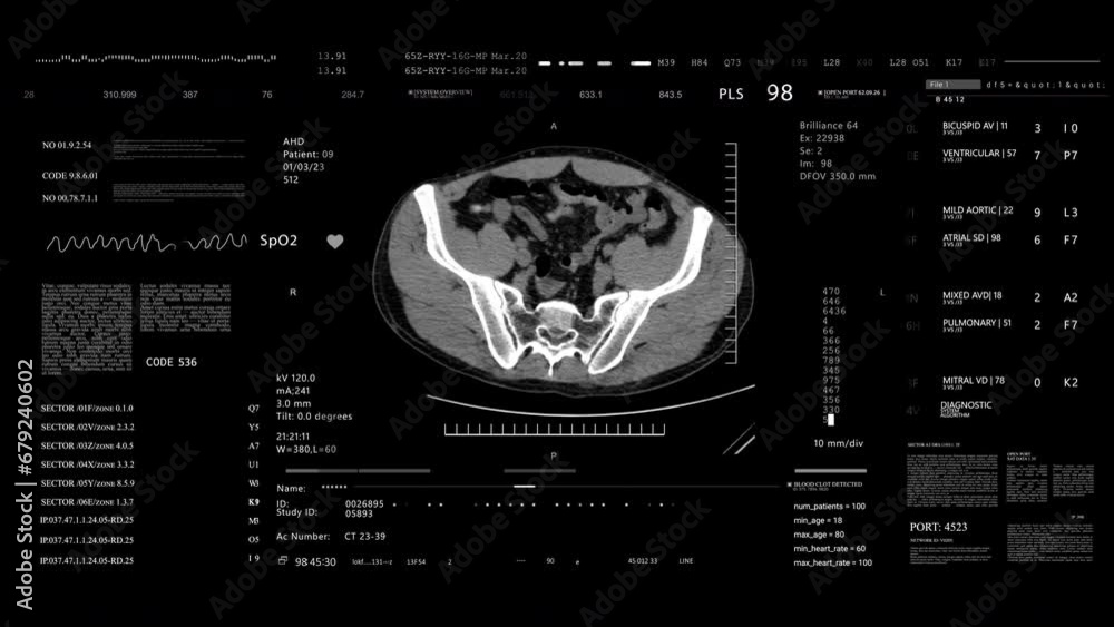 Medical UI HUD.CT scan. MRI x ray Scan. Analyzing abdominal diagnosis ...