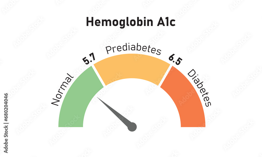 Hemoglobin A1c Test Levels Concept Design. Vector Illustration. Stock ...