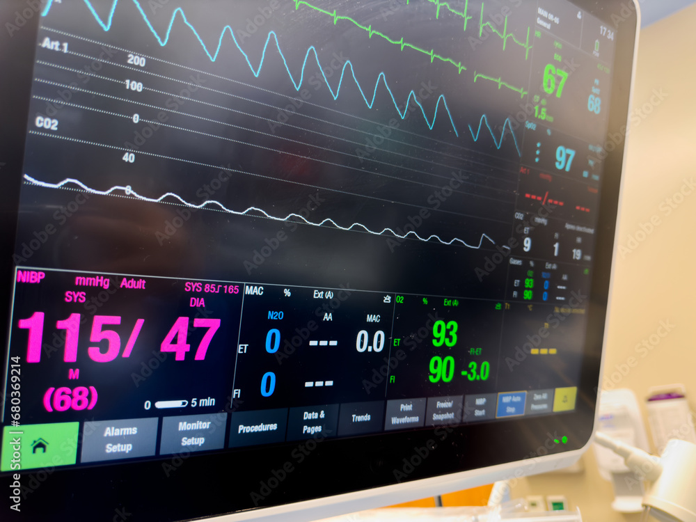 Hospital monitor displaying vital signs: heart rate, blood pressure ...