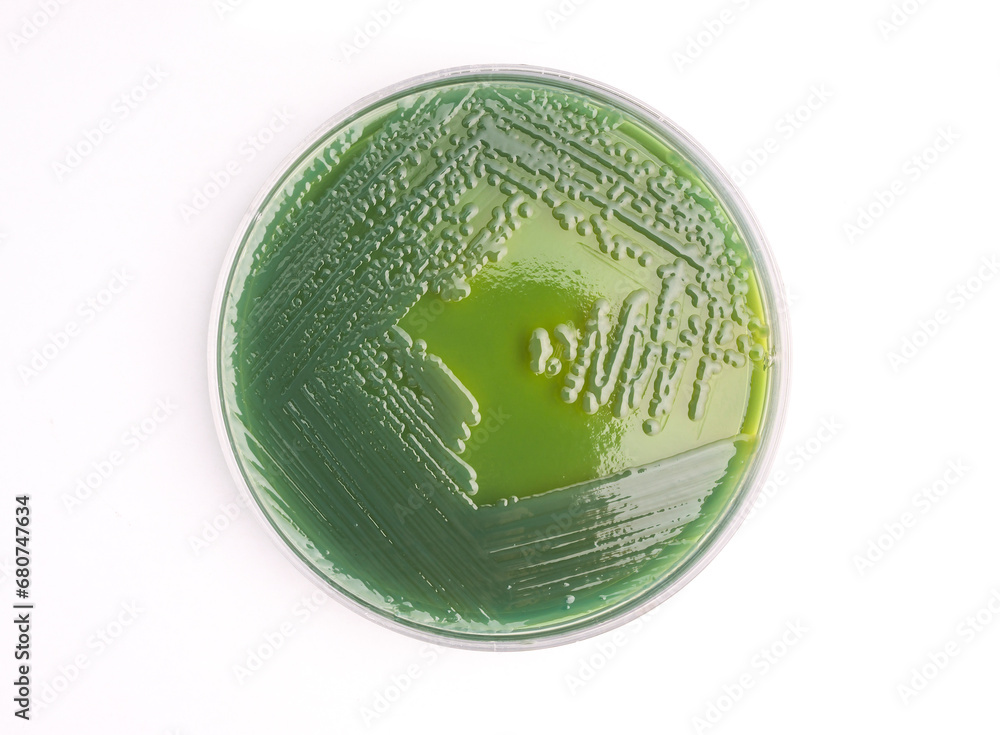 Vibrio parahaemolyticus colonies growing in a petri dish with ...