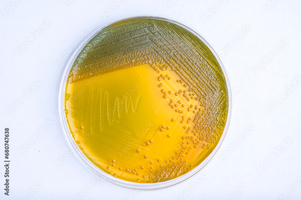 Vibrio cholerae colonies growing in a petri dish with Thiosulfate ...