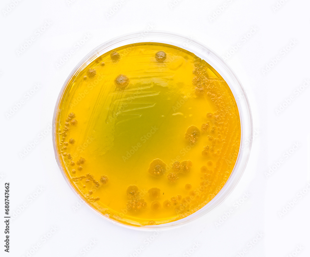 Vibrio alginolyticus colonies growing in a petri dish with Thiosulfate ...