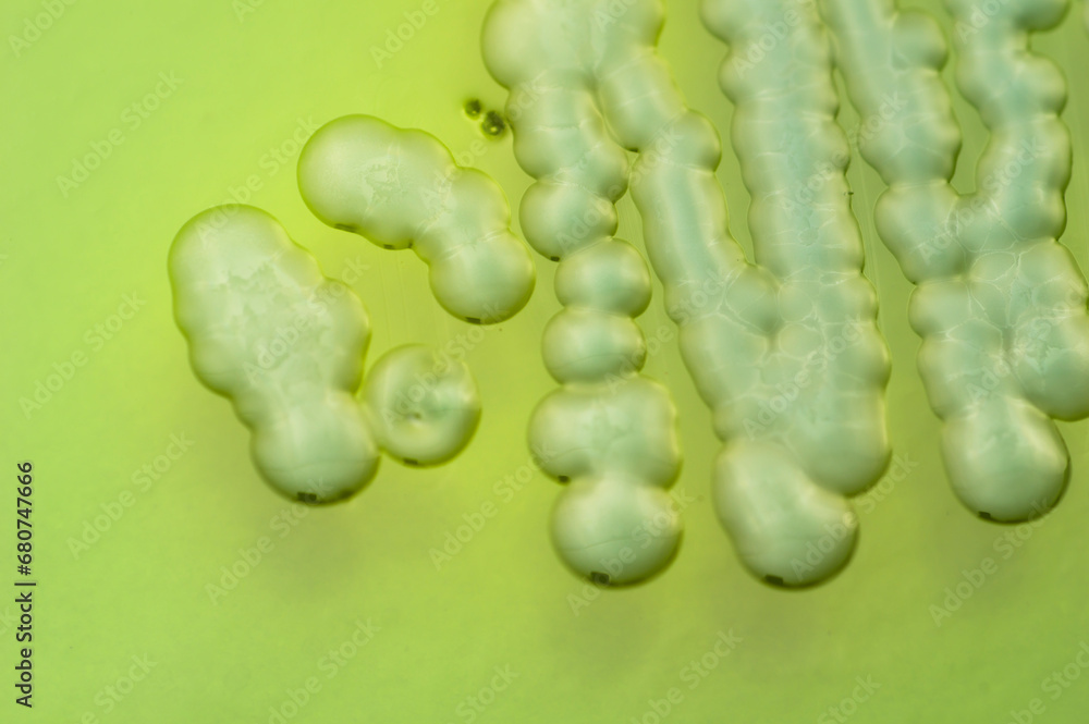 macro view of Vibrio parahaemolyticus colonies growing in a petri dish ...