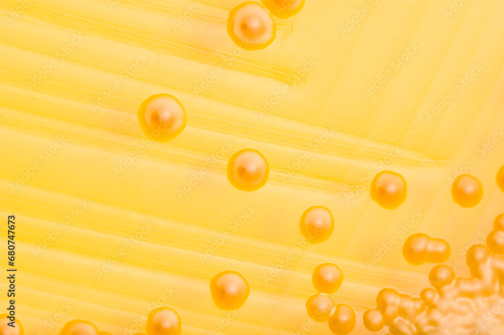 Vibrio cholerae, macro view of colonies growing in a petri dish with ...