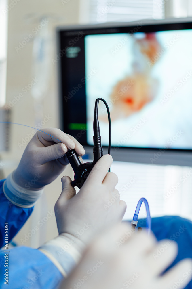 Operation robotic laparoscopy. Endoscopy modern surgery technologies ...