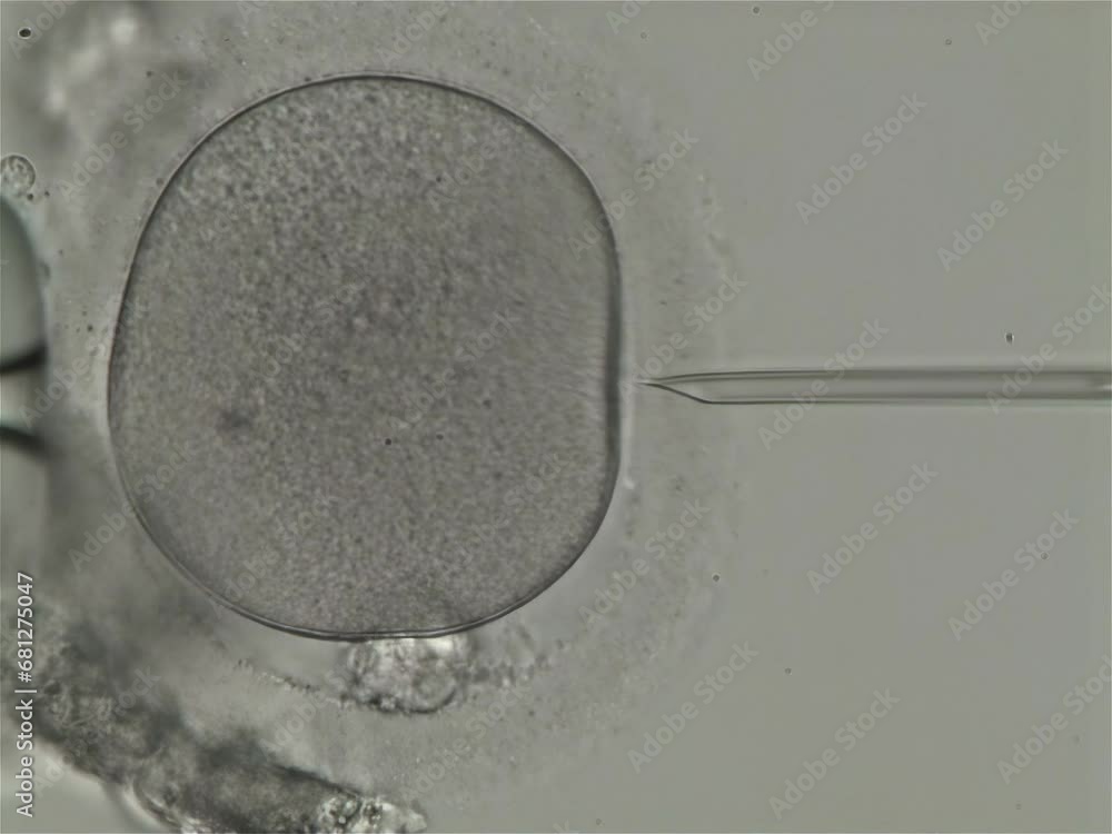 Using a needle for the medical IVF Procedure under a microscope. Adding ...
