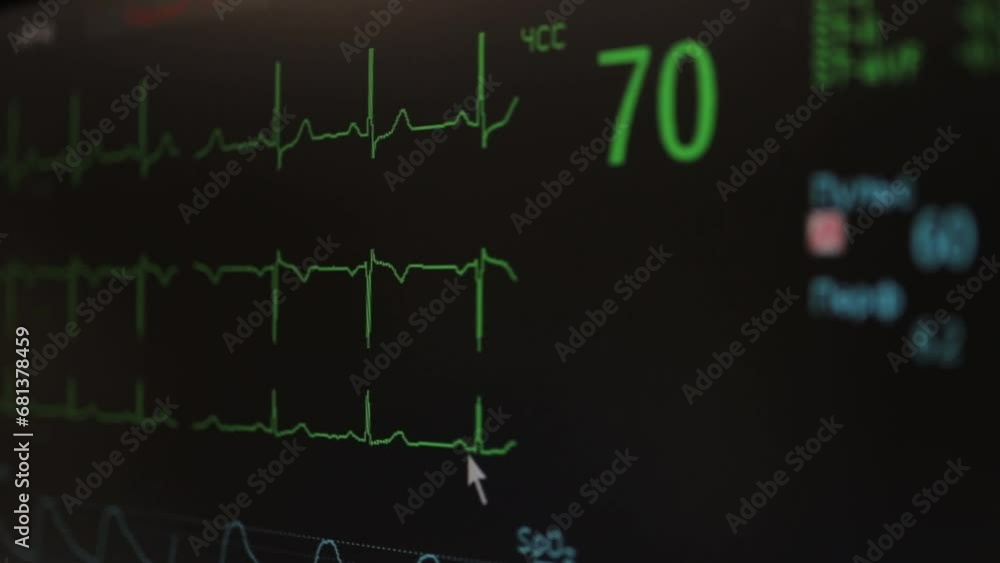 Heart rate monitor in hospital theater. Medical device for monitoring ...