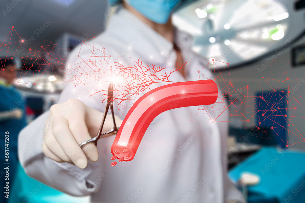 Concept of surgical treatment of blood vessel disease. Stock Photo ...