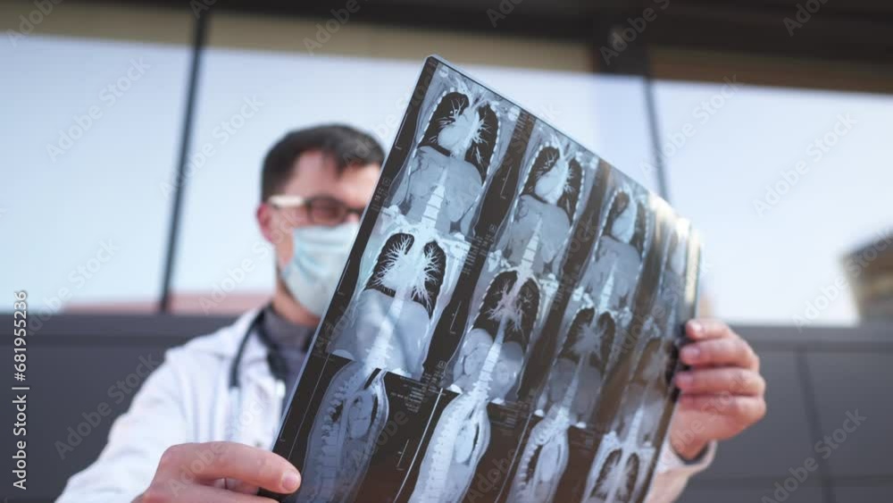 Doctor examines CT scan of chest and abdomen. X-ray or mri for the ...