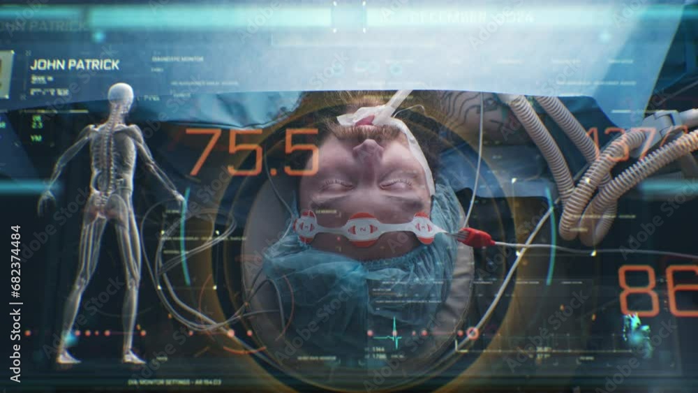 Man under anesthesia lies during surgery in modern hospital operating ...