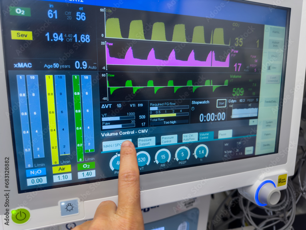 hospital monitor displaying vital signs: heart rate, blood pressure ...
