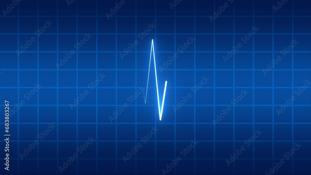 Neon Electrocardiogram Heartbeat Pulse monitoring Medical Patient Heart ...
