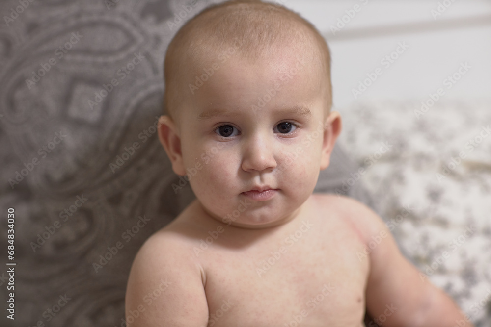 A baby's rash, a rash on the skin, a harmless non-dangerous viral ...