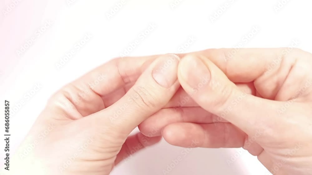 White spots on the female fingernails. Examination and diagnosis of the ...