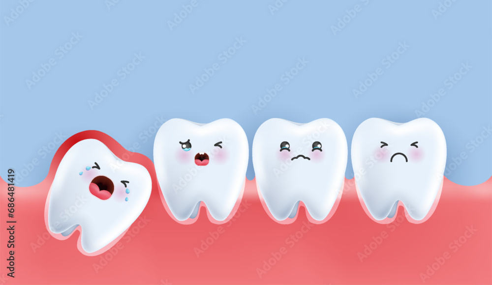 Wisdom teeth under the gums cause pain in the mouth. Impacted wisdom ...