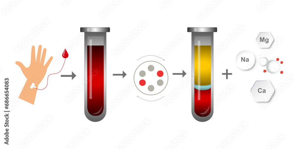A tube filled with blood for the injection of platelet-rich plasma. PRP ...