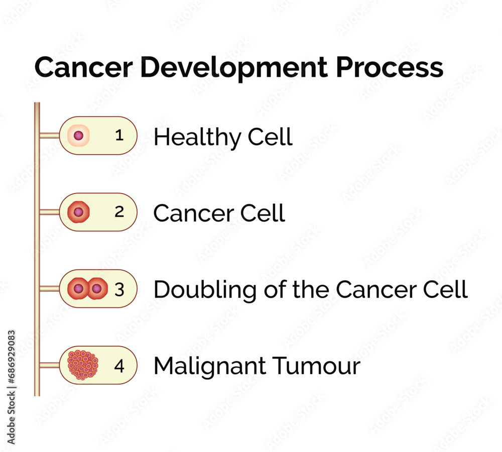 Cancer Cell Development Process Science Design Vector Illustration ...