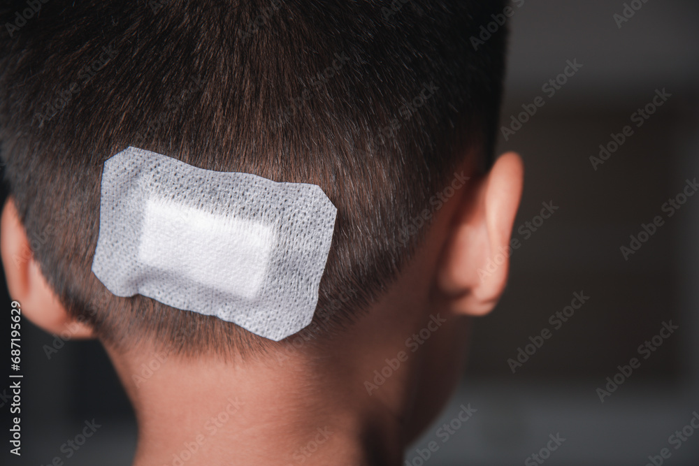 The lacerated suture wound of kid back head which suture with trauma ...