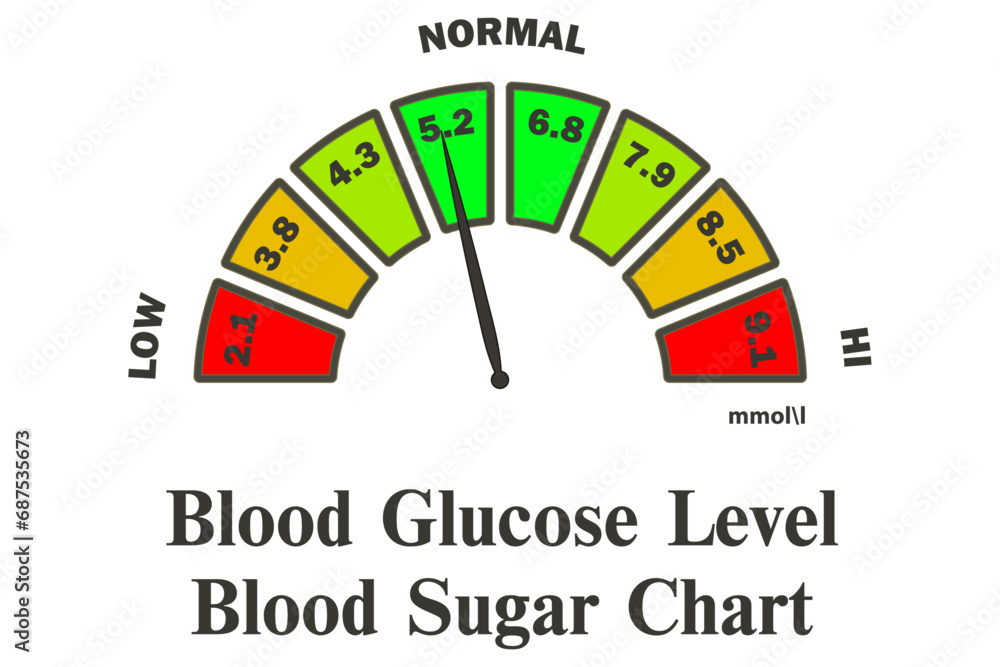 Glucose Levels Chart Indicator Gauge With Colour Scale And Arrow Glucose Levels Chart Indicator Gauge With Colour Scale And Arrow
