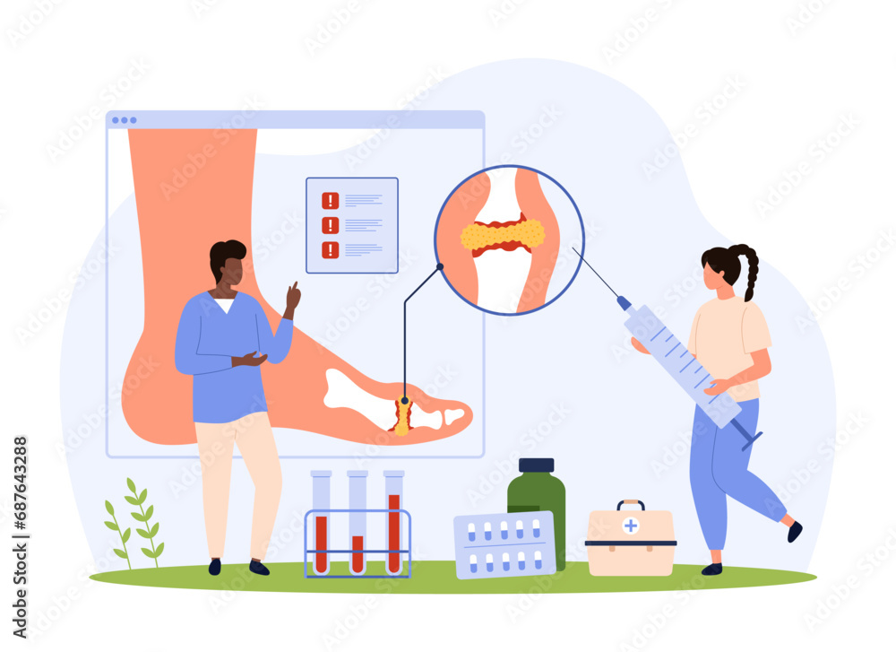 Gout diagnosis and treatment, rheumatology vector illustration. Cartoon ...