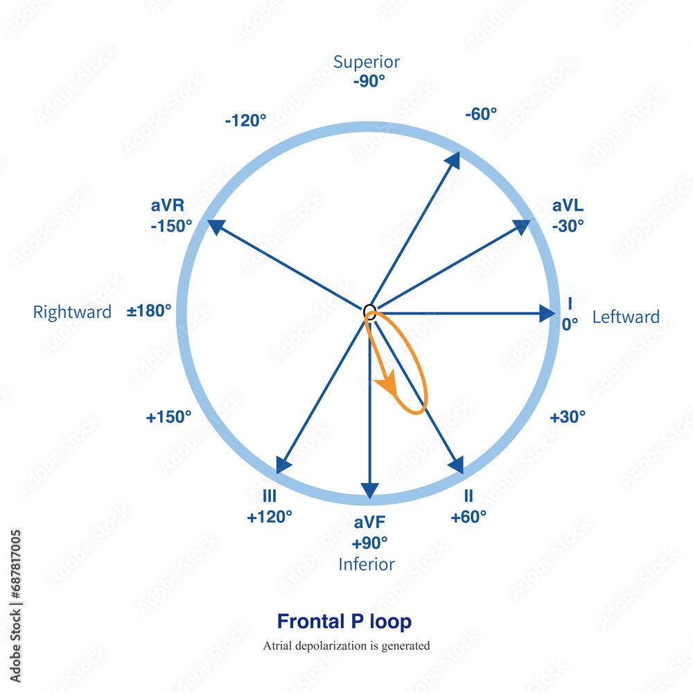 1535 FrontalWhen the atrium is depolarized, a spatial depolarization ...