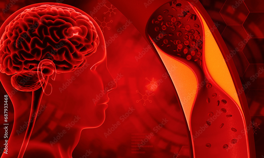 Human brain with Clogged arteries on scientific background. 3d ...