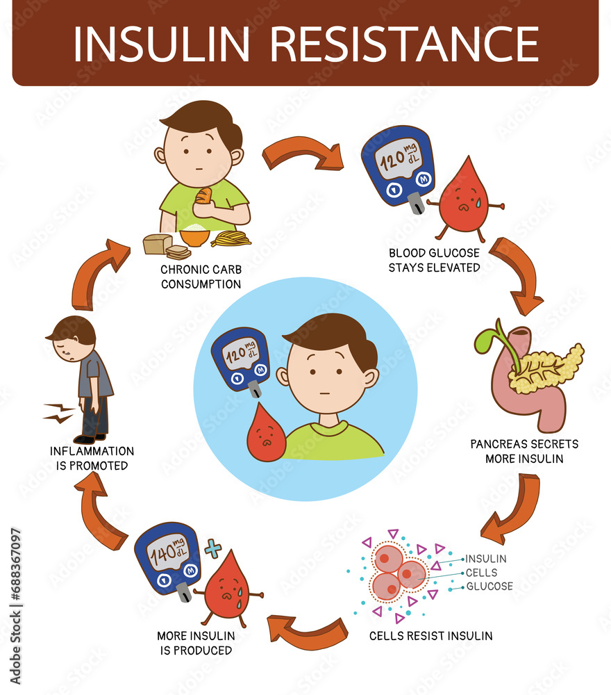 Insulin resistance syndrome, illustration cartoon on white background ...