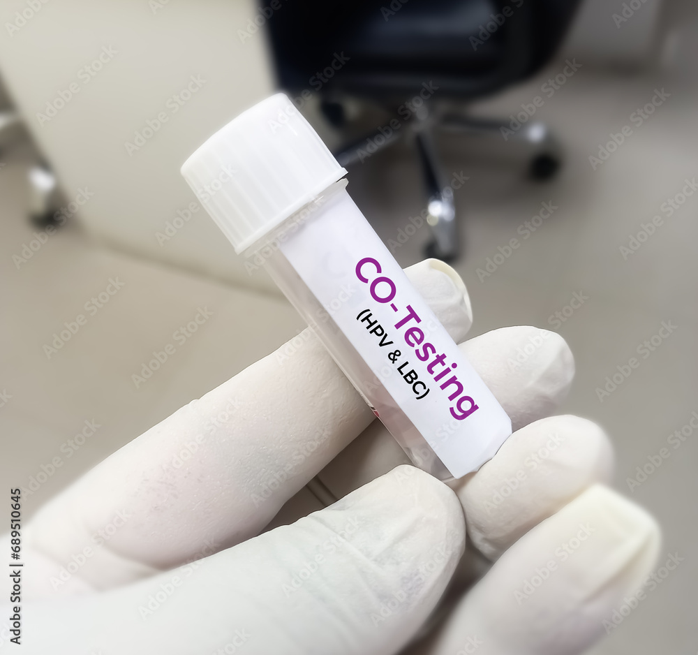Vaginal fluid sample for CO-Testing (HPV DNA test and LBC test), Human ... Vaginal fluid sample for CO-Testing (HPV DNA test and LBC test), Human ...