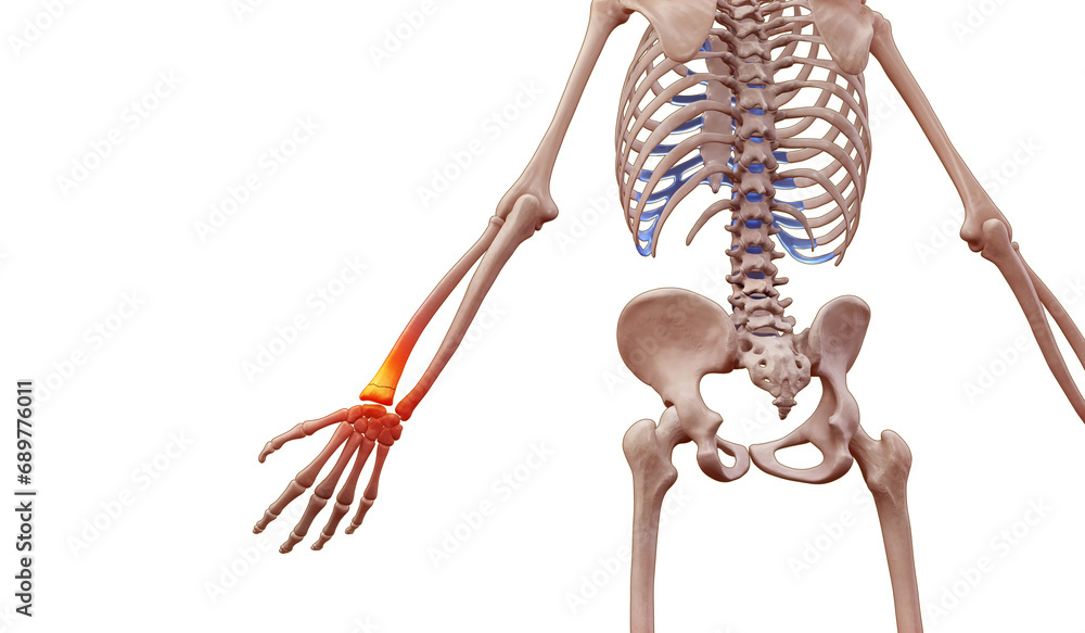 3D medical illustration of a human skeleton with wrist pain injury ...
