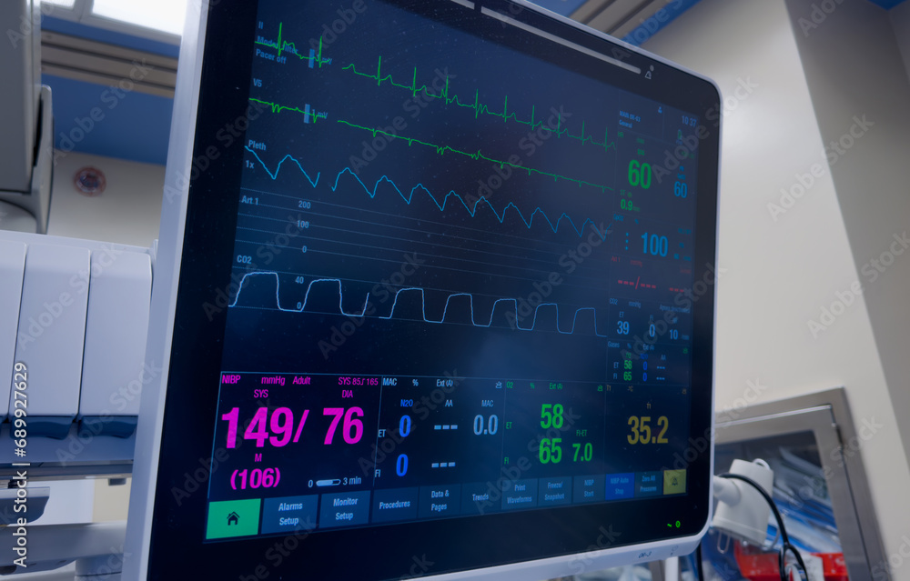 hospital monitor displaying vital signs and hemodynamics, illustrating ...