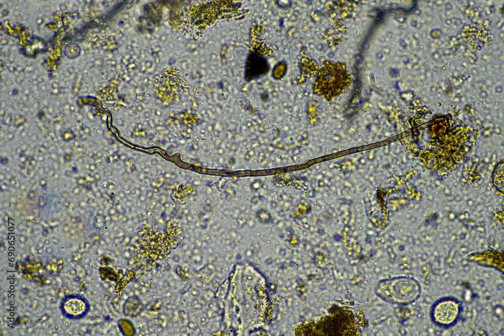 microscopic microorganisms under the microscope in a soil sample Stock ...