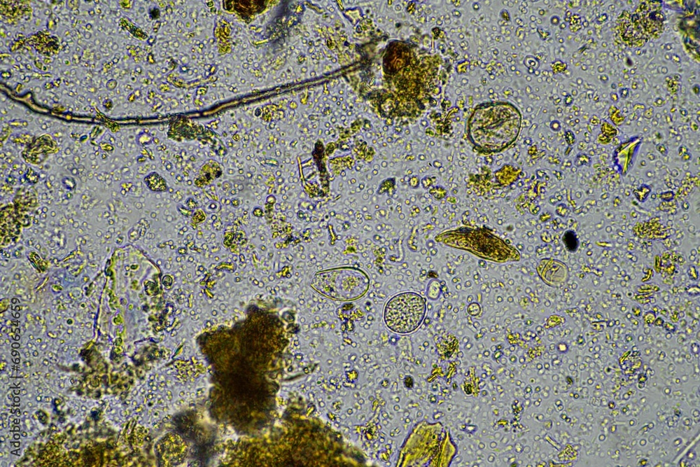 soil microbes under the microscope. microorganisms with fungus Stock ...